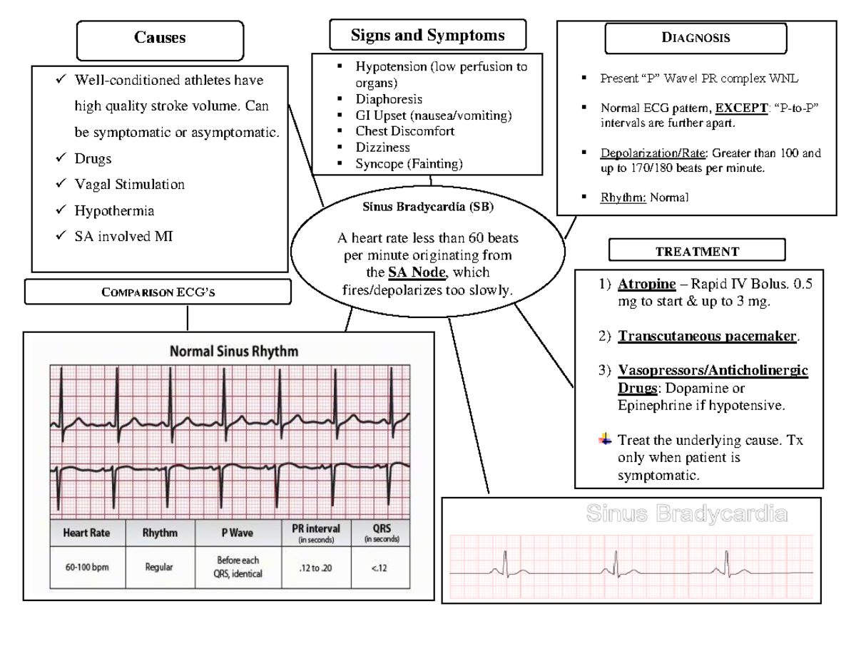 Cardiac Dysrhythmias: A Comprehensive Concept Map Study Guide - Studocu
