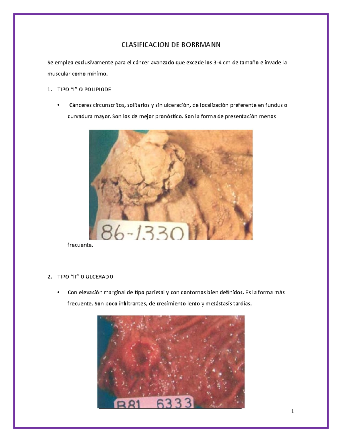 Clasificación de Borrmann en Cáncer Avanzado: Tipos y Características ...