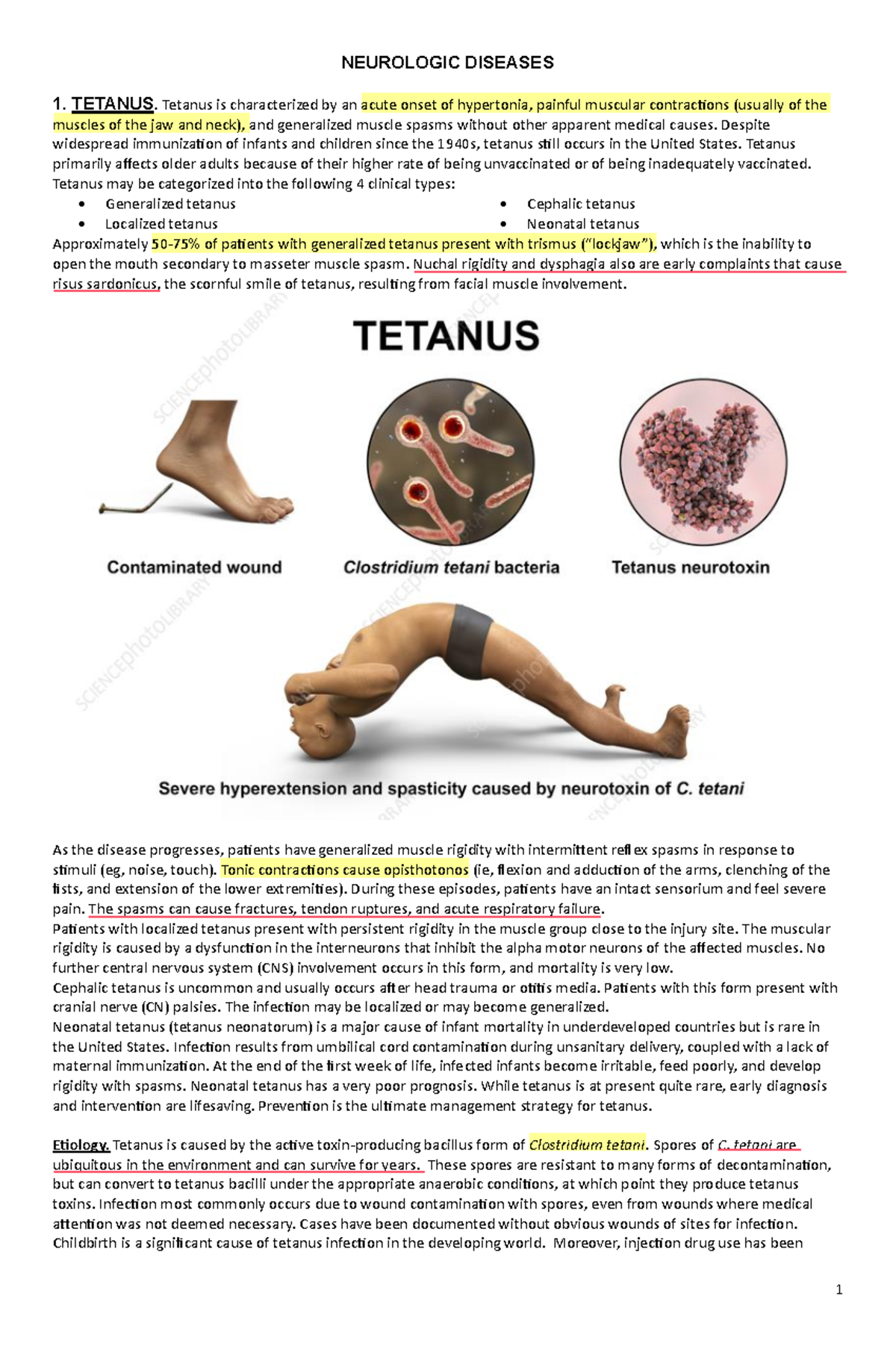 Lesson-5 - Neurological disease - NEUROLOGIC DISEASES 1. TETANUS ...