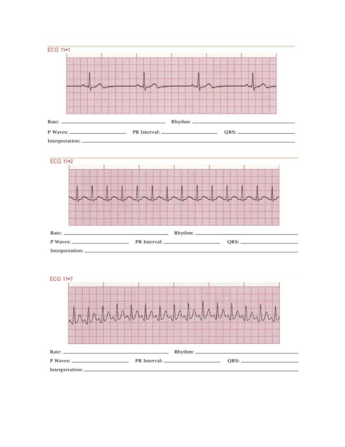 ECG Interpretation Case Study ALA: Analyzing Patient Management - Studocu