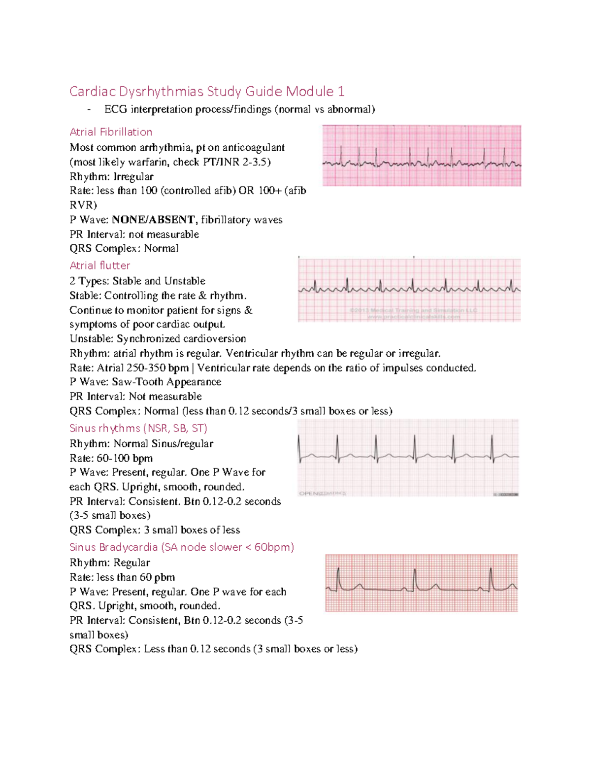 Cardiac Dysrhythmias Study Guide M1: ECG Findings & Arrhythmia Types ...
