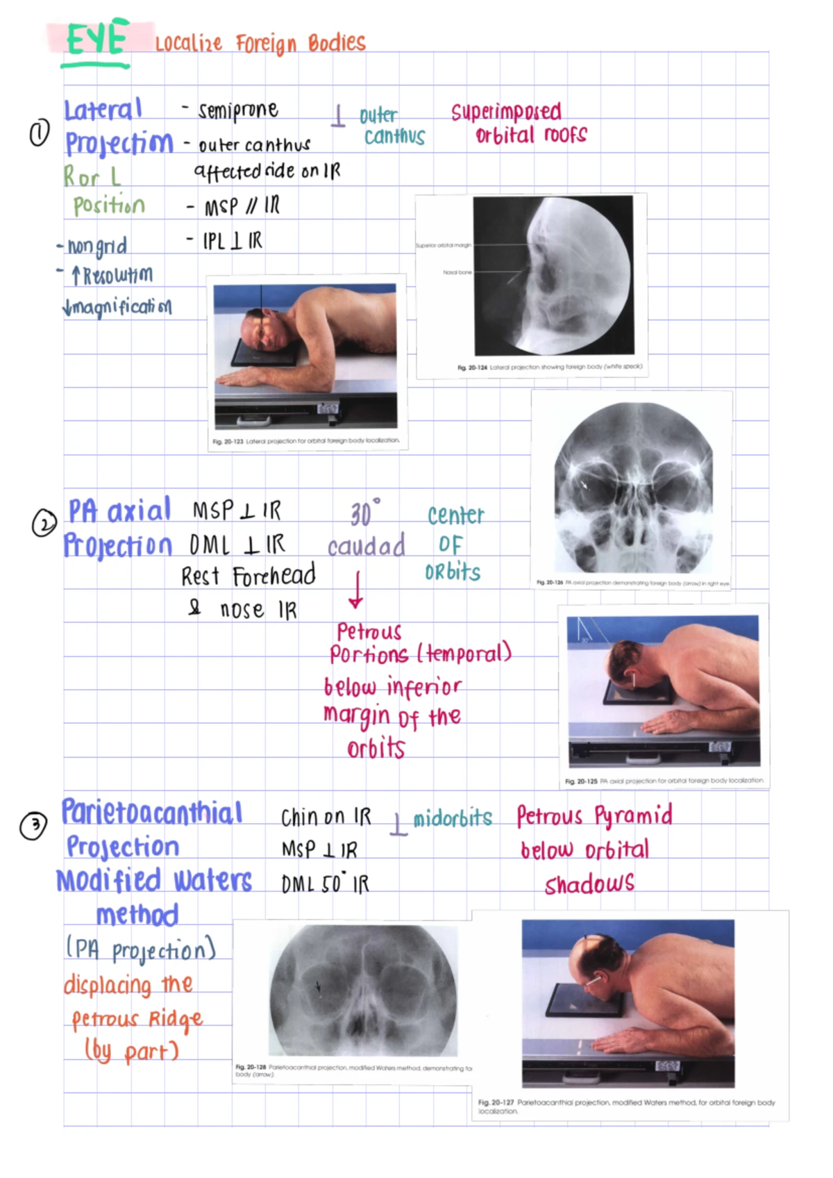 Clavicle Positioning Guide: AP and Axial Projections Medical Notes ...