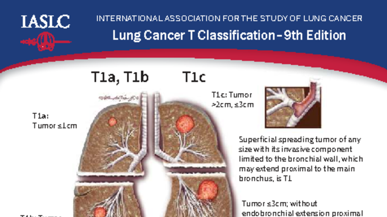 IASLC Lung Cancer Staging Cards: 9th Edition 2024 - Studocu