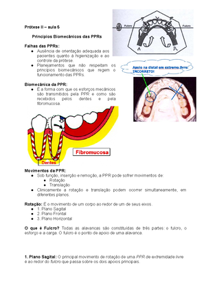 Aula 6 - Técnicas de moldagem em PPRs - Procedimentos de moldagem em ...