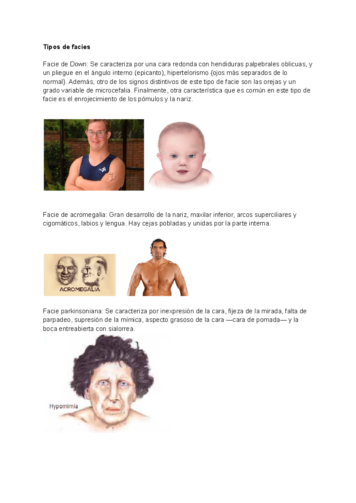 Tipos de Facies: Características y Descripciones clínicas - Studocu