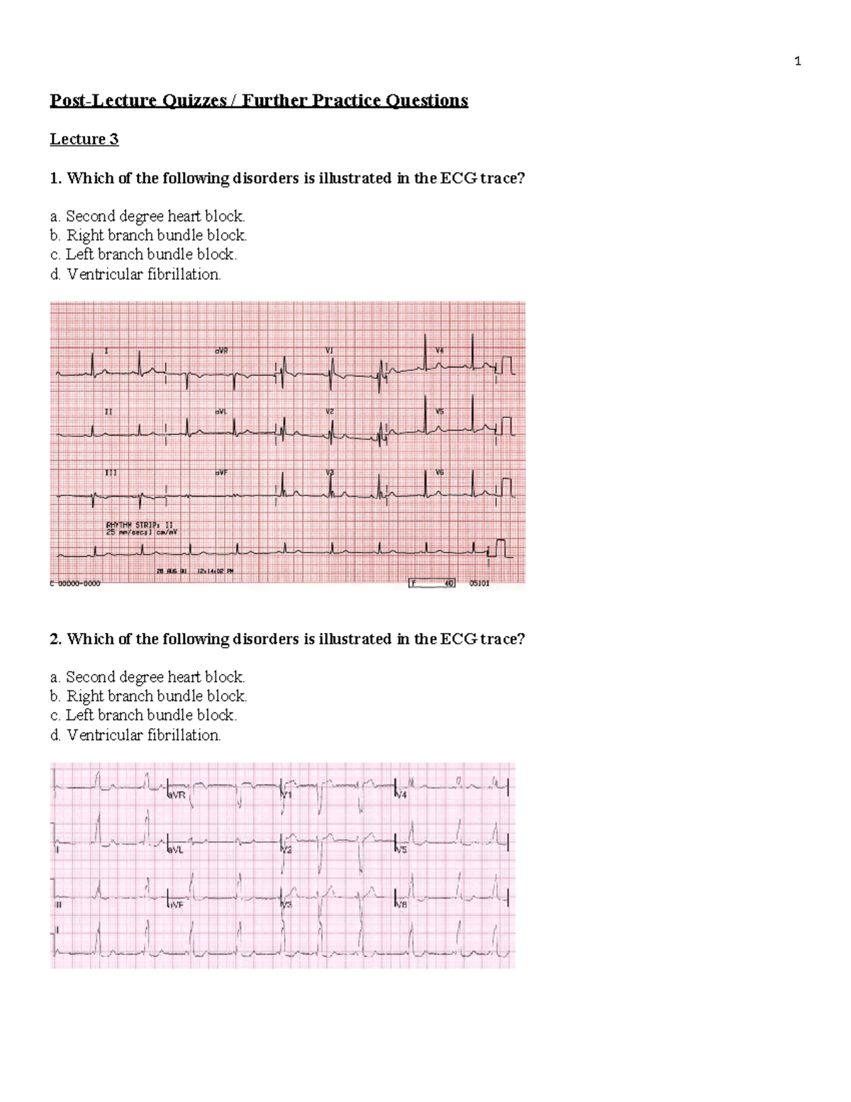 Quiz Lecture 3 - ECG Disorders and Electrical Axis Analysis - Studocu