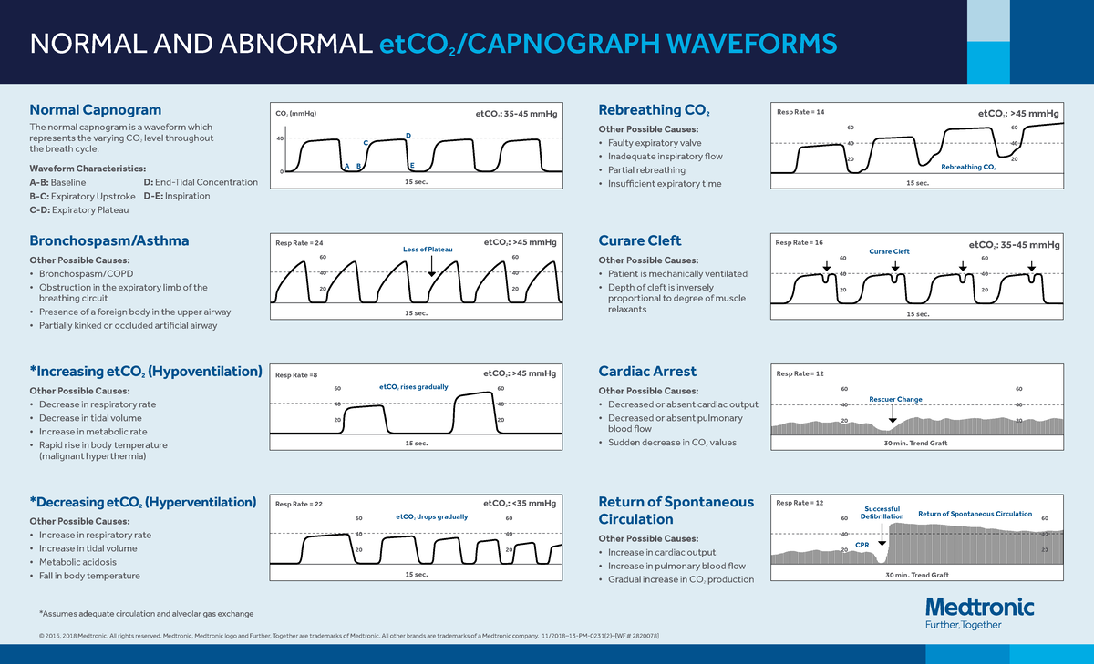 Capnography normal and abnormal waveforms poster - Waveform ...
