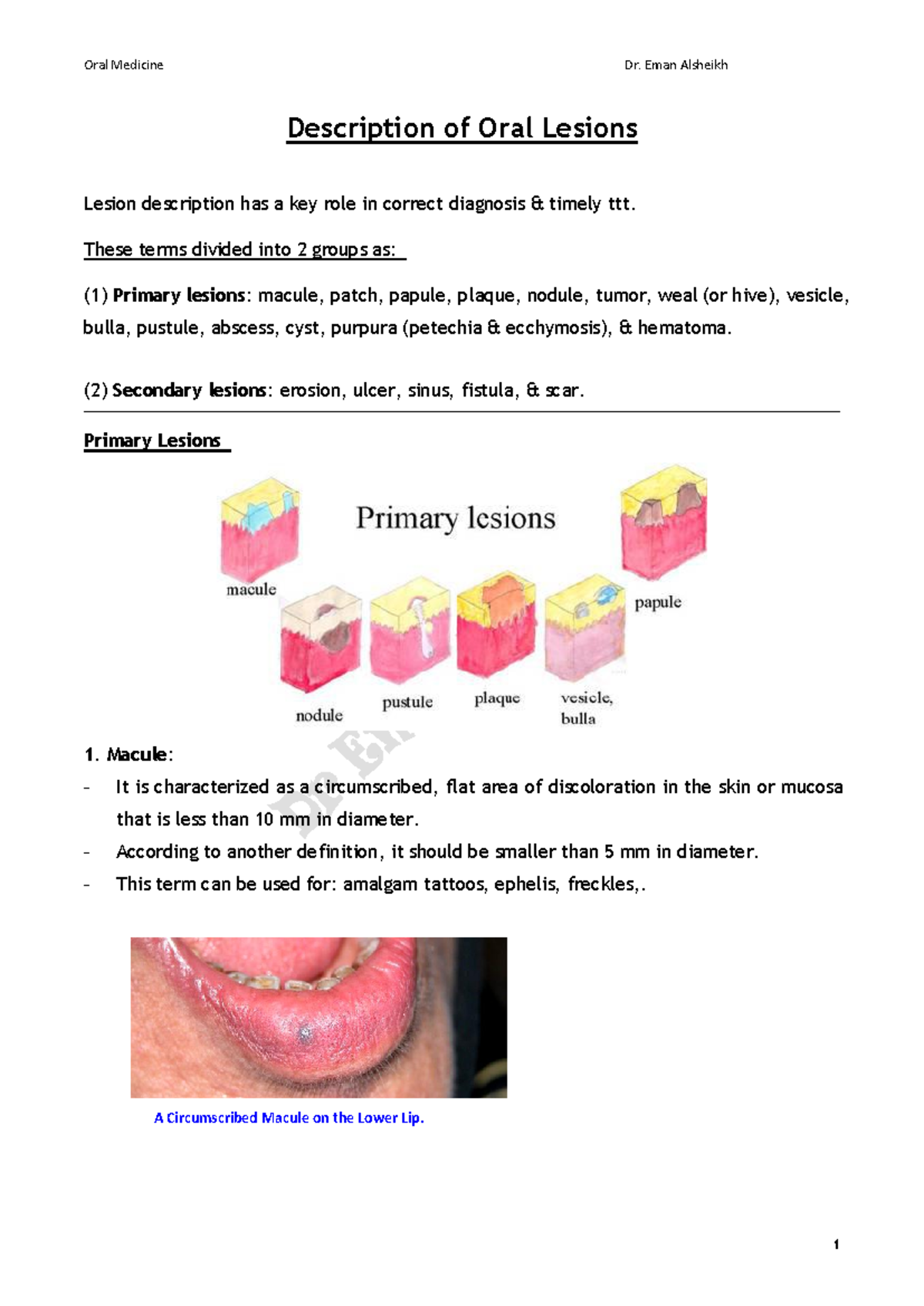 Description of oral lesions - Description of Oral Lesions Lesion ...