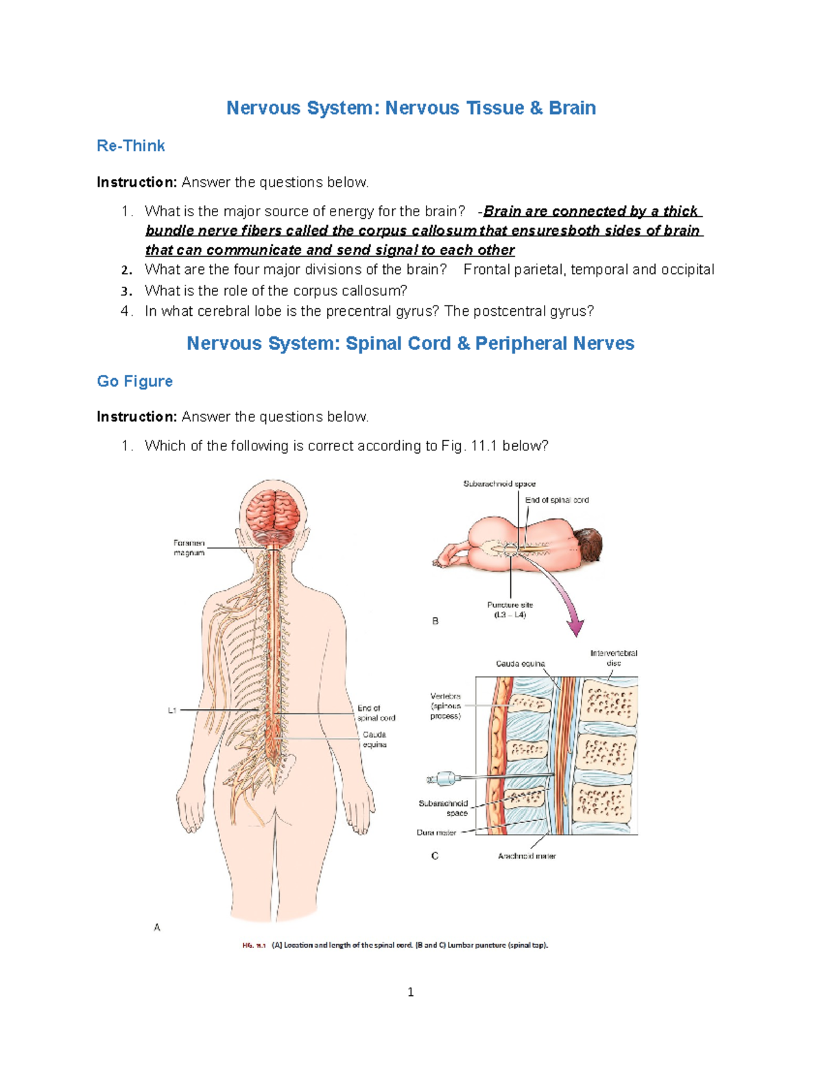 AHP106 Wk3 Assignment - Nervous System: Nervous Tissue & Brain Re-Think ...