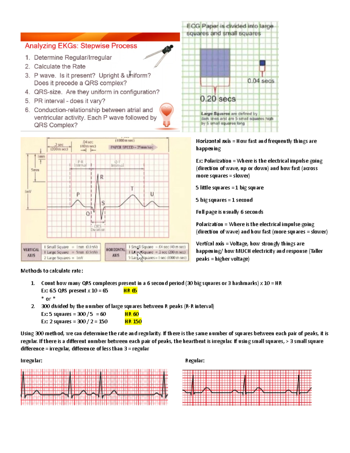 ECG Interpretation Cheat Sheet: Key Concepts & Calculations - Studocu