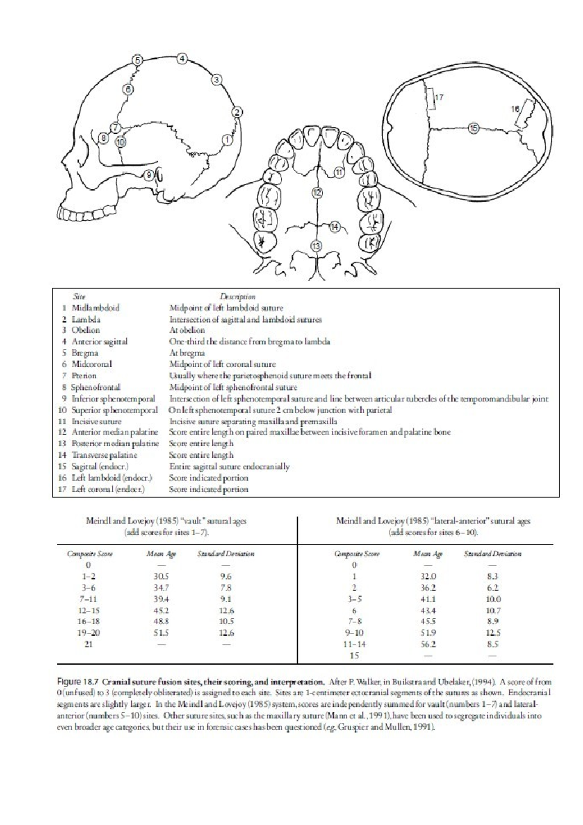 AGE Determination: Cranial Suture Fusion Sites and Scoring - Studocu