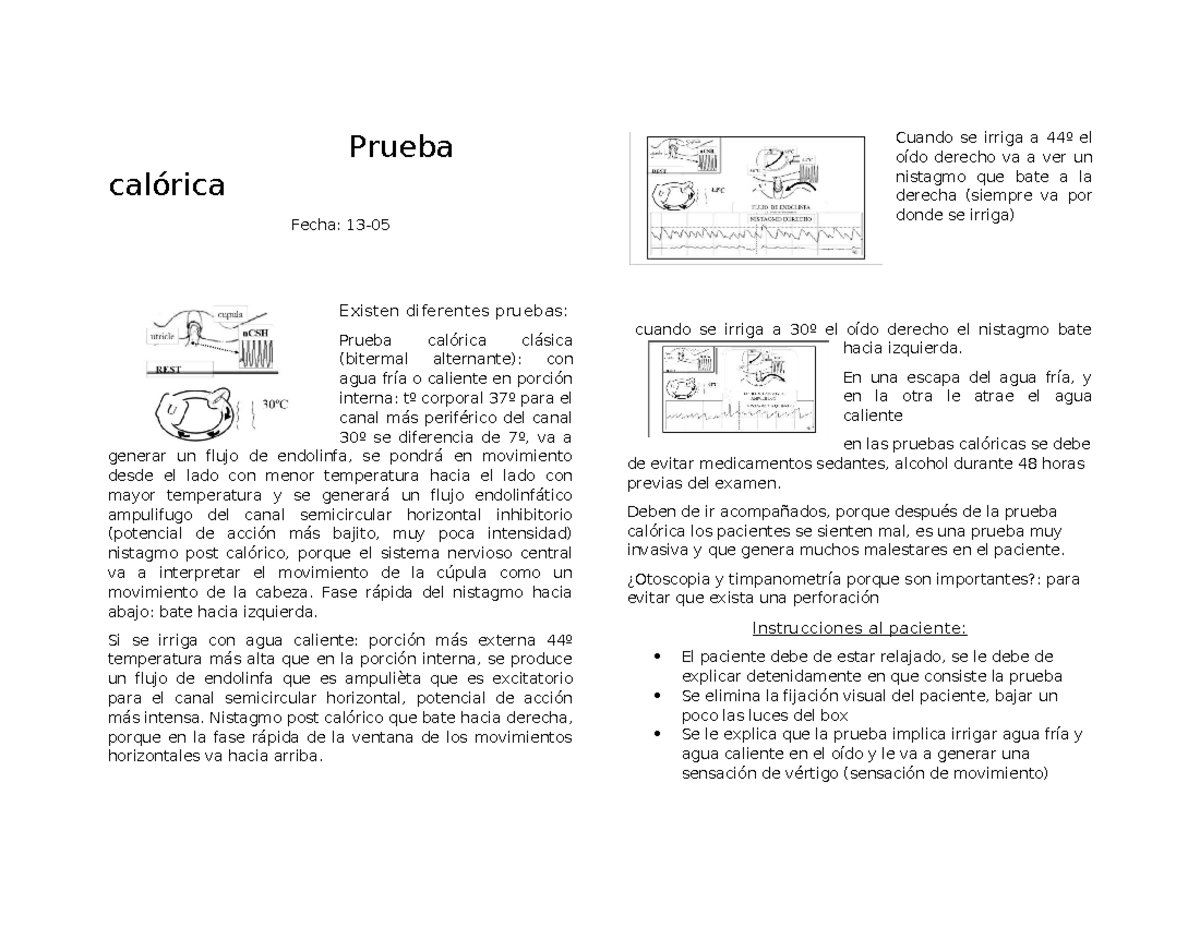 Prueba Calórica: Evaluación del Nistagmo y Procedimientos Clínicos ...
