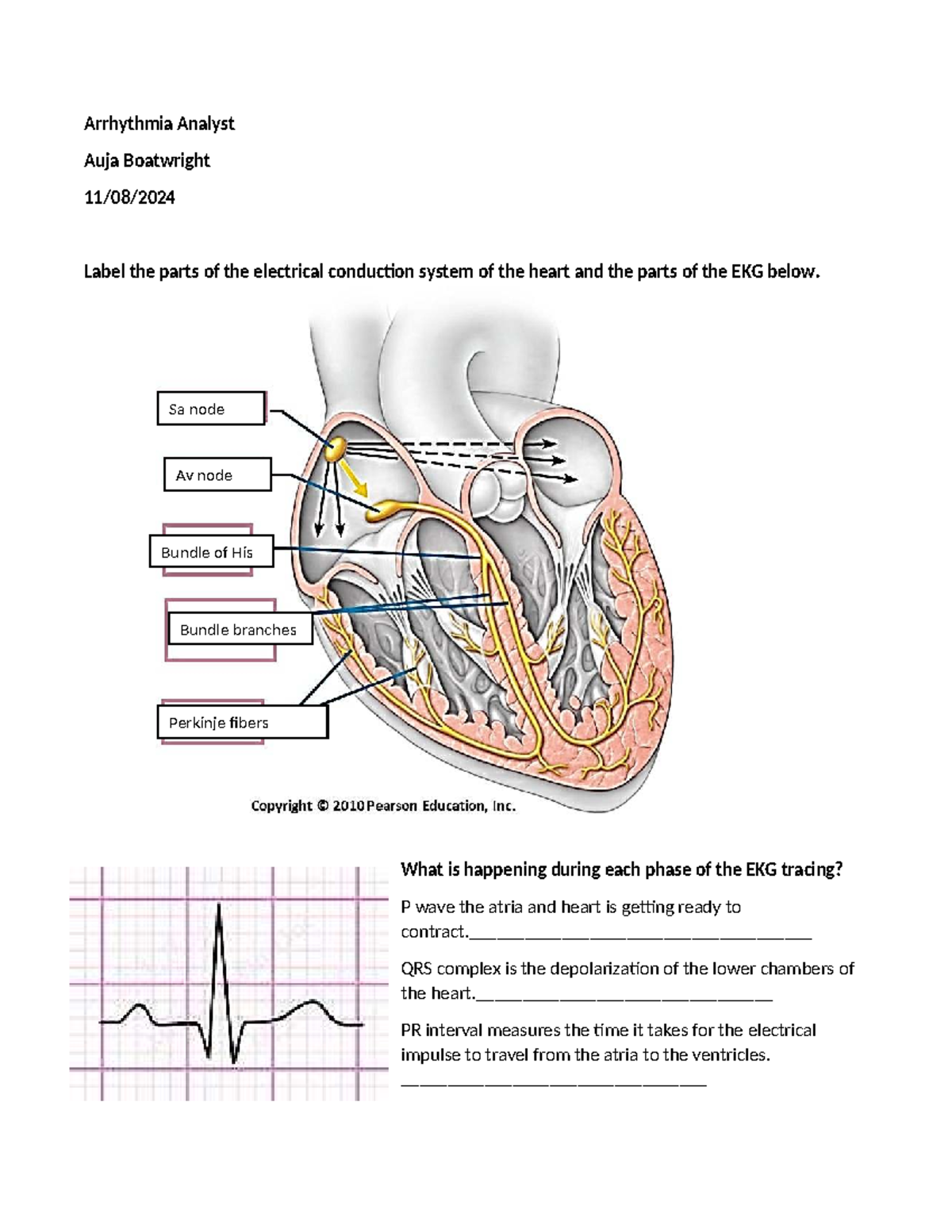 Arrhythmia analyst - labeling the heart's electrical conduction system ...