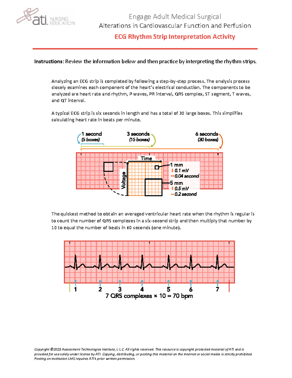 Engage-AMS ECG Rhythm Strip Interpretation Activity Guide - Studocu
