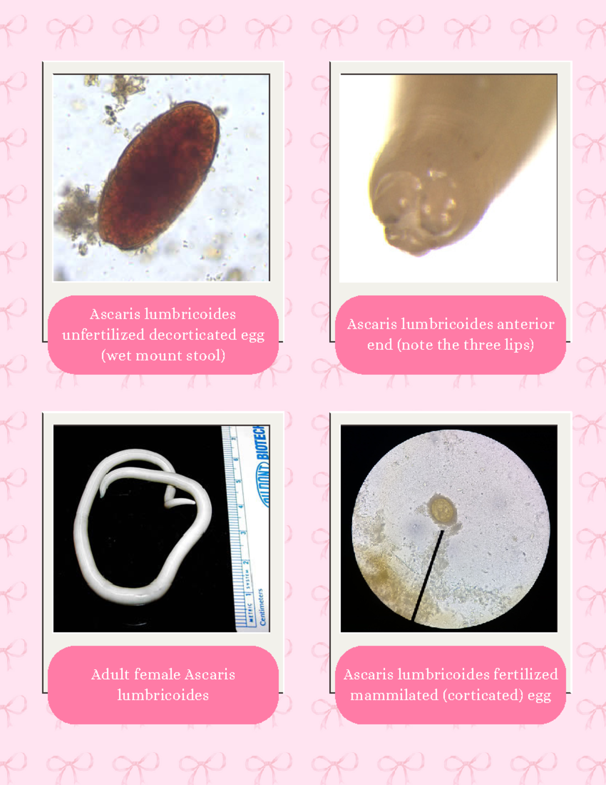 Microscopic images - Ascaris lumbricoides unfertilized decorticated egg ...