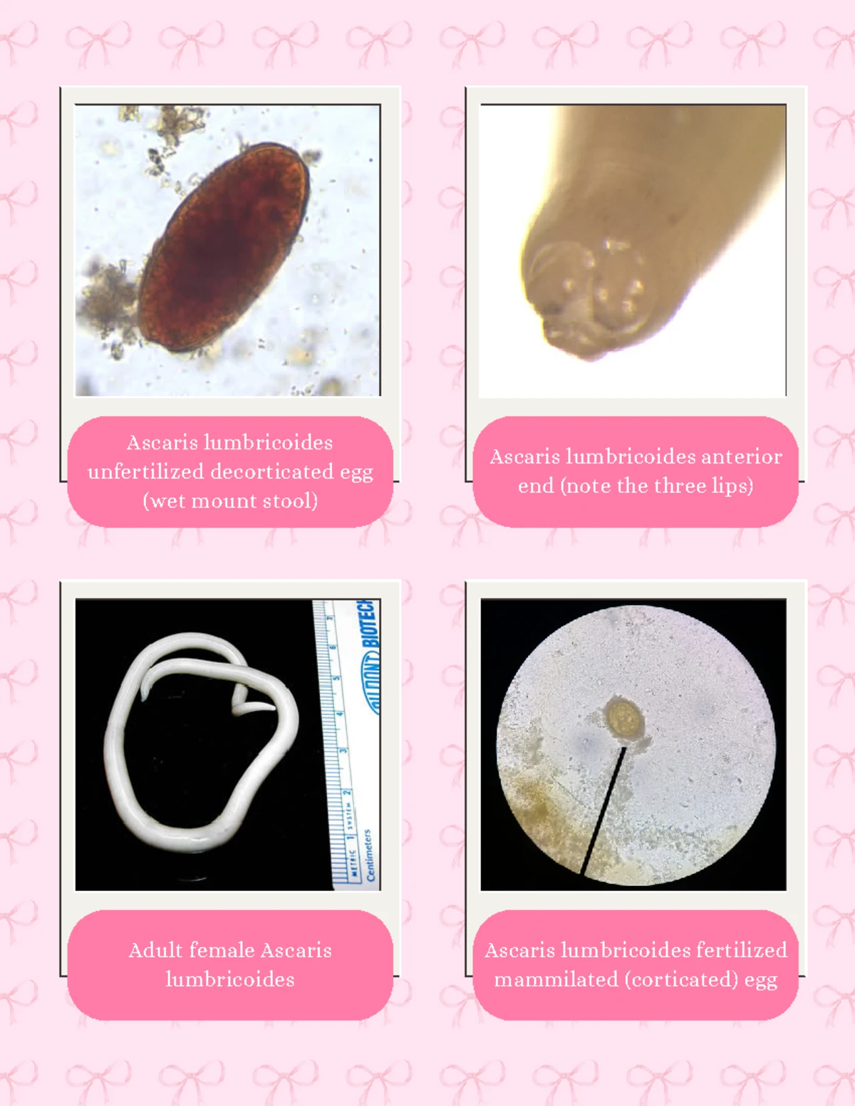 Microscopic Images of Parasites - Detailed Study Guide - Studocu