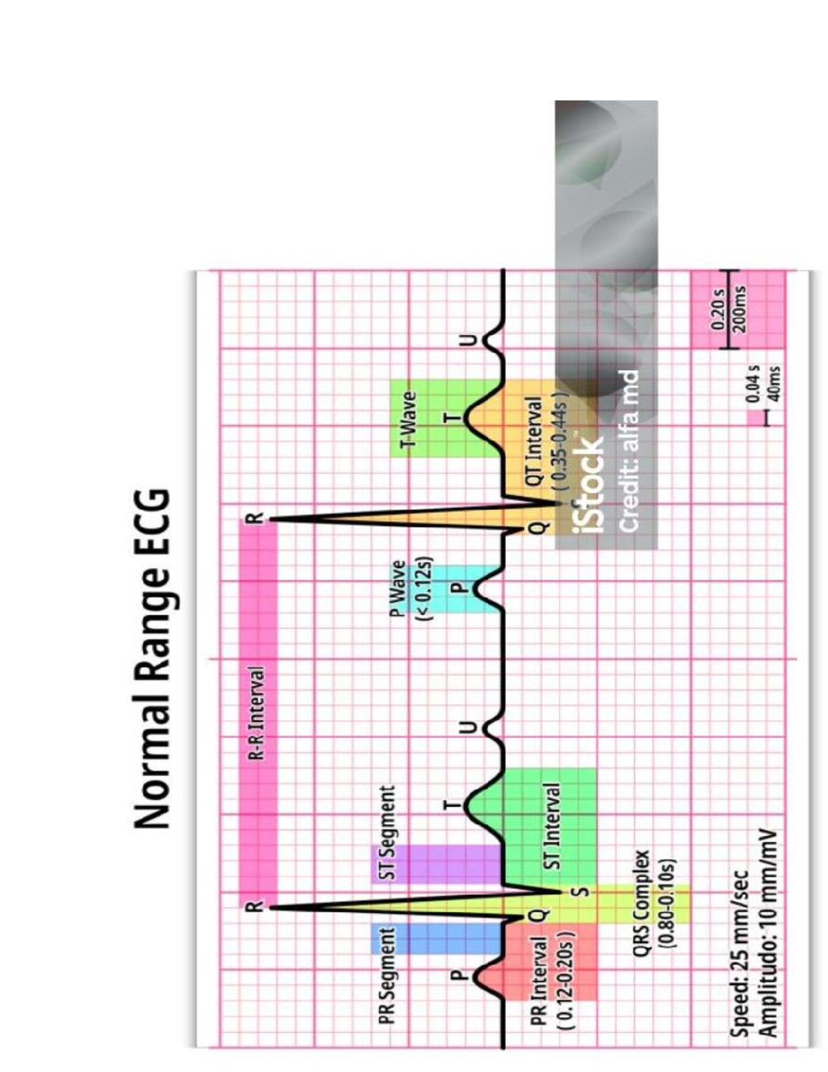 Basic ECG Waveform Analysis: A Guide to Reading ECGs - Studocu