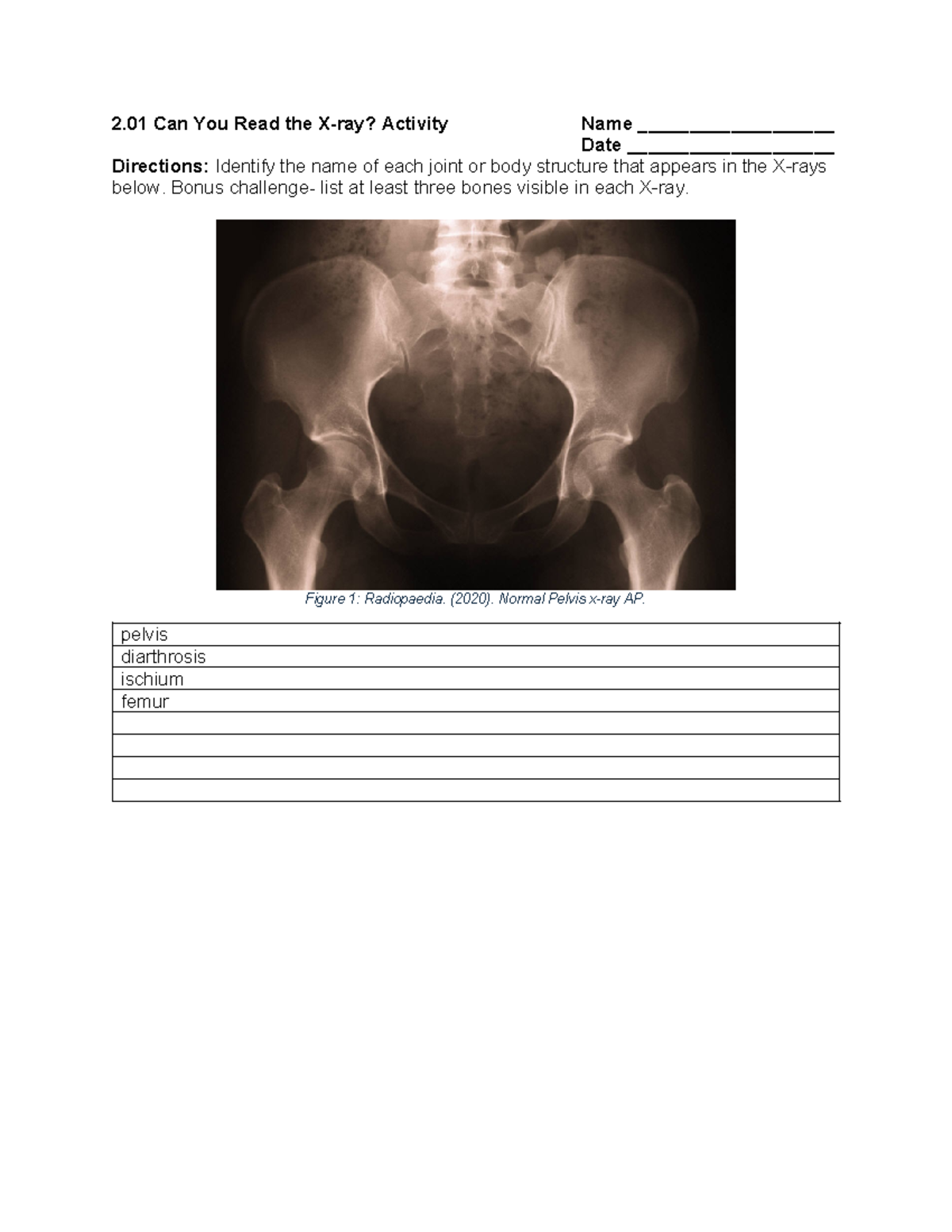 2.01 Can You Read the X-ray Activity - Bonus challenge- list at least ...