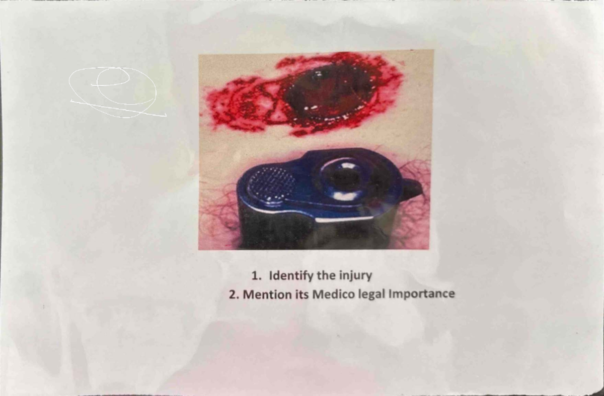 Community Medicine Charts: Injury Identification & Medico-Legal ...