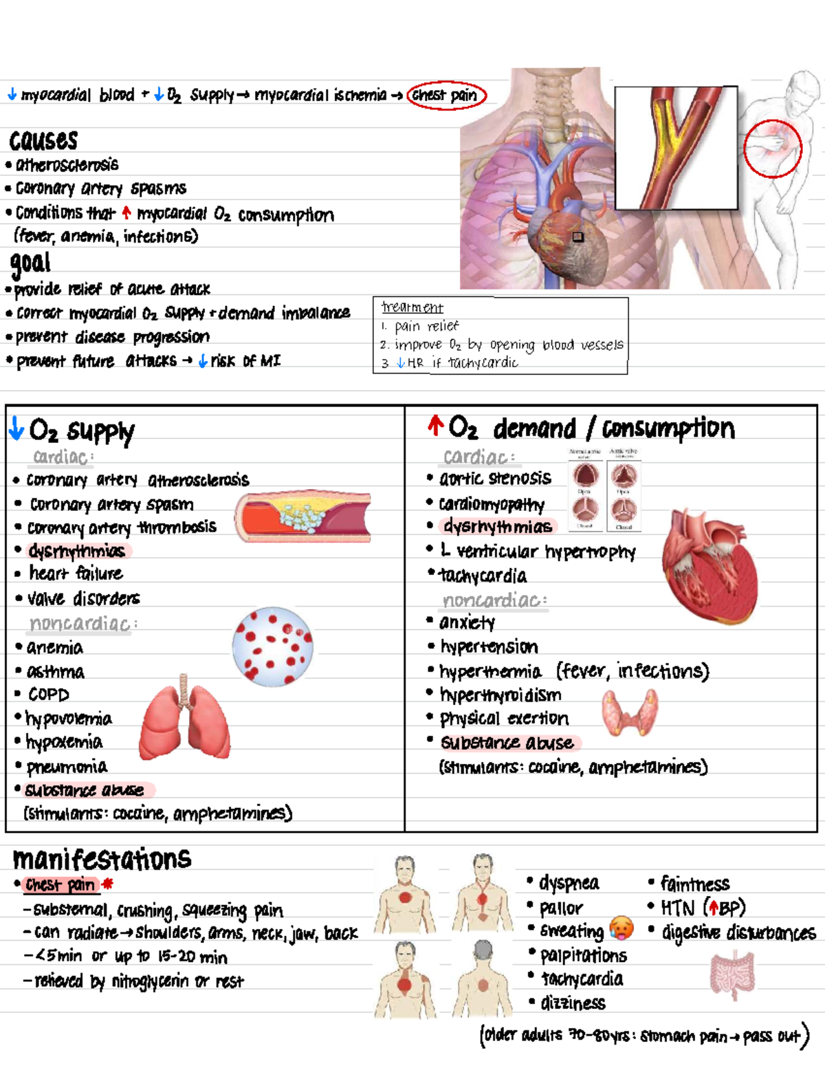 Angina 2: Understanding Myocardial Ischemia and Treatment Options - Studocu