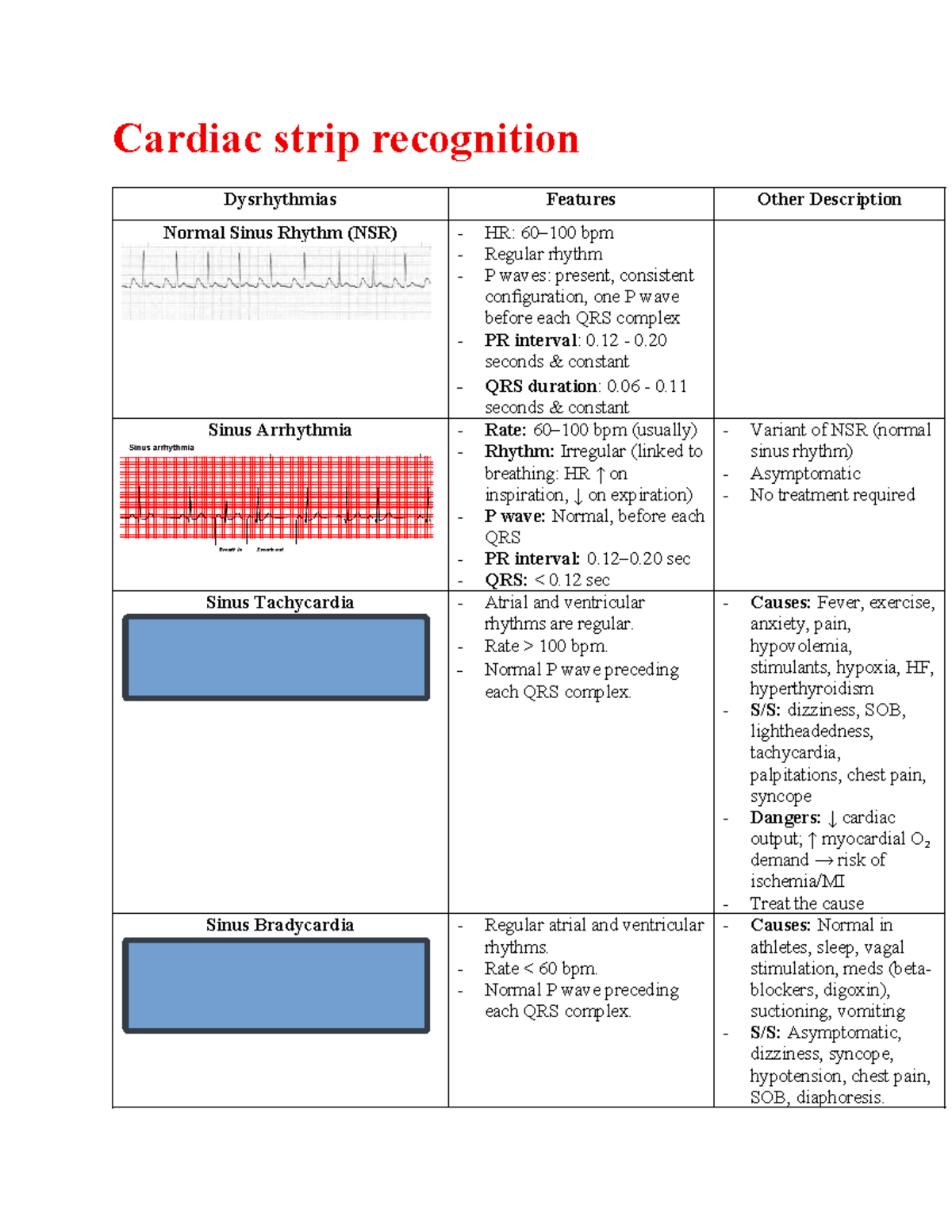 Dysrhythmia Management and Interventions for Clinical Practice (NURS ...