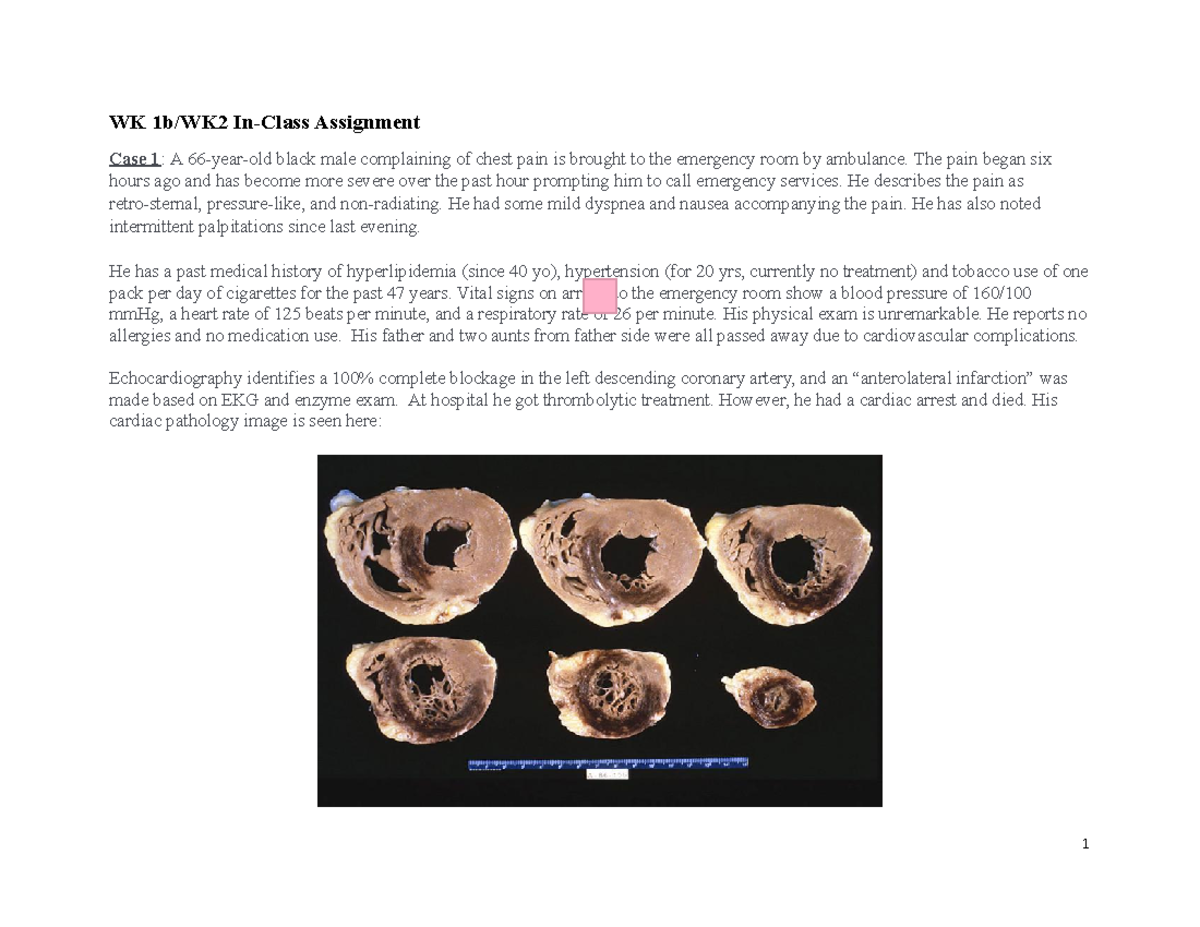 WK2 WK1b In Class Assignment - WK 1b/WK2 In-Class Assignment Case 1: A 66-year-old black male ...