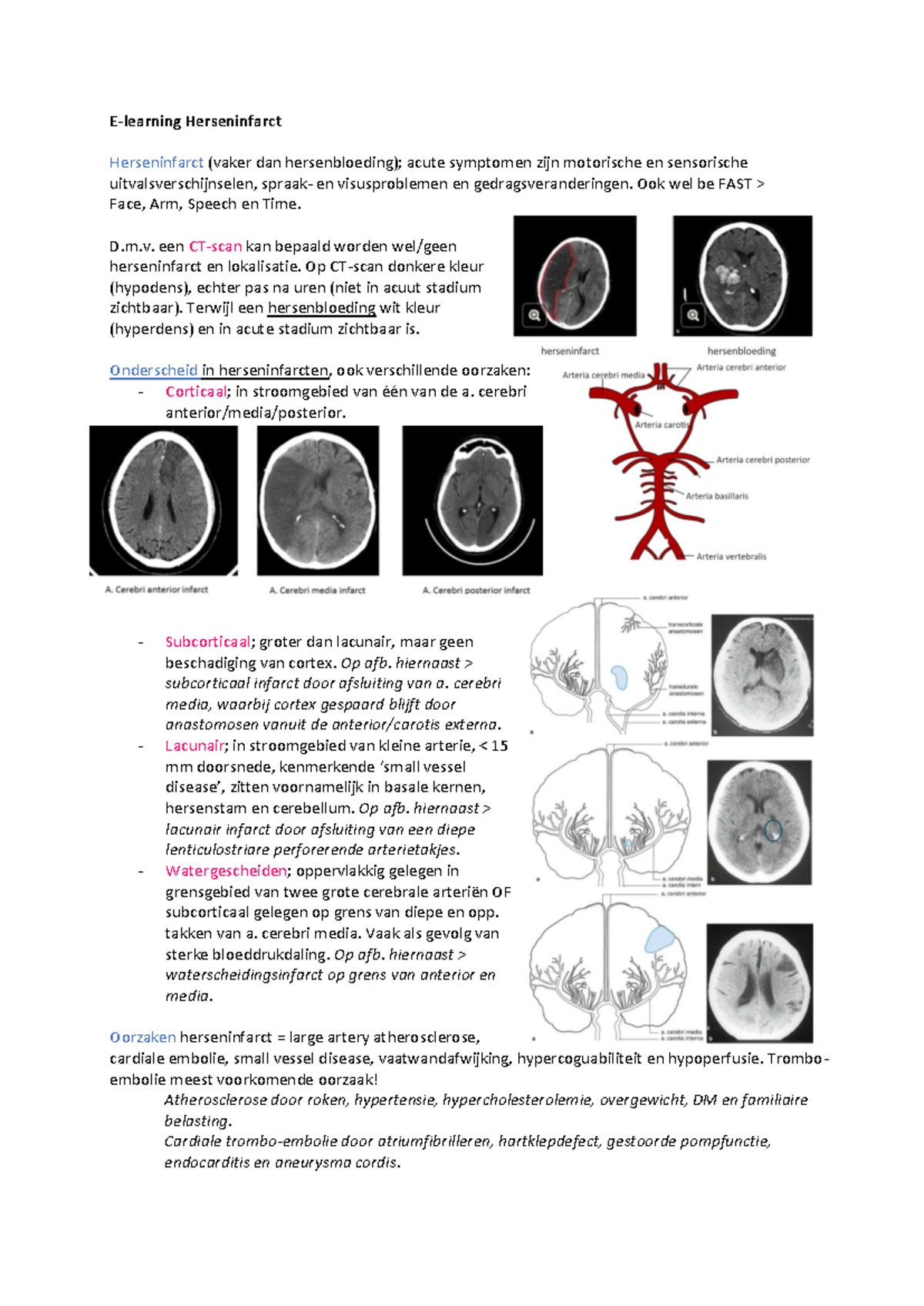 E-learning Herseninfarct Q6 - E-learning Herseninfarct Herseninfarct ...