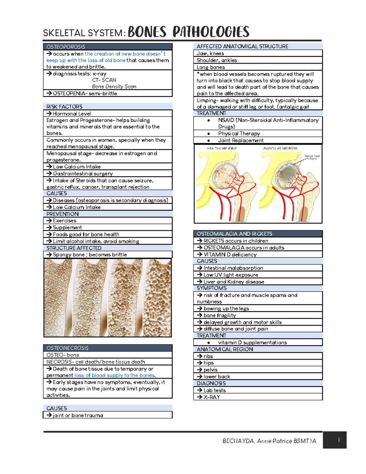 ANATOMY AND PHYSIOLOGY BONE Pathologies: Osteoporosis and More - Studocu