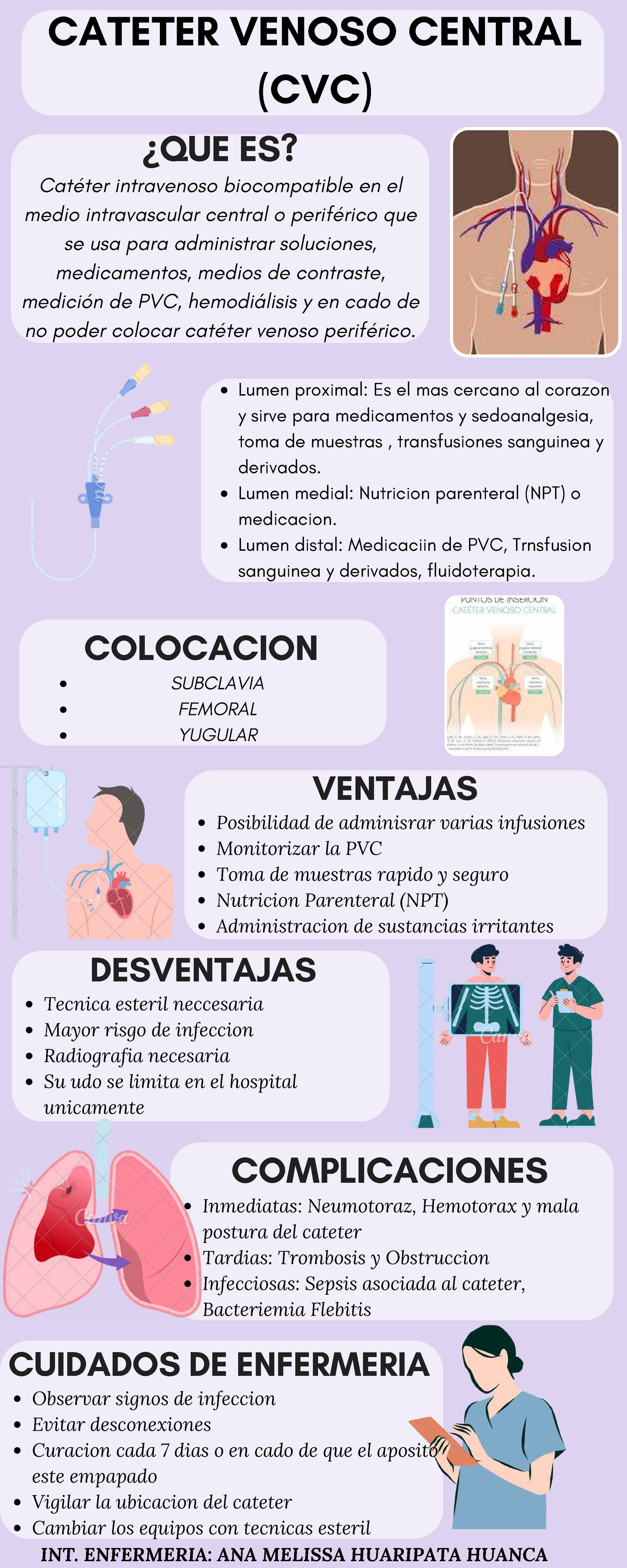 Infografía sobre Catéter Venoso Central (CVC) y Cuidados de Enfermería ...