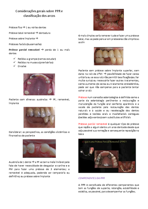 Aula 6 - Técnicas de moldagem em PPRs - Procedimentos de moldagem em ...