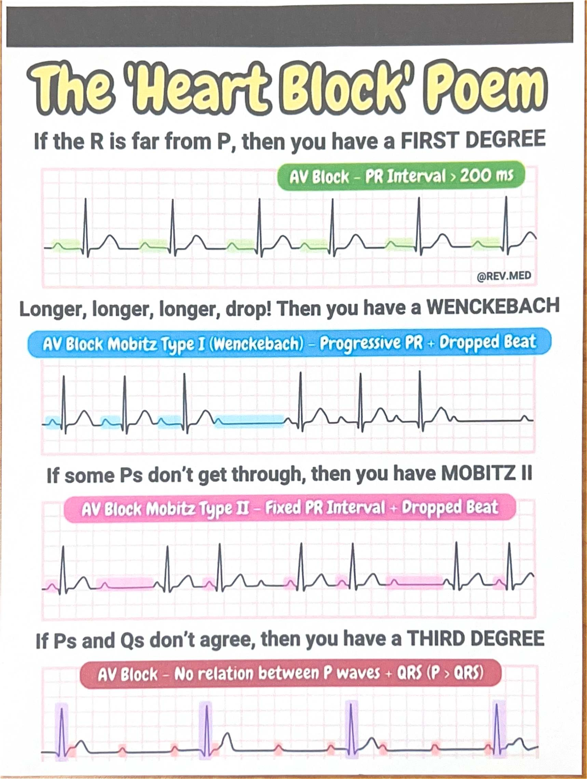 Heart Block Poem: Understanding AV Blocks and PR Intervals - Studocu
