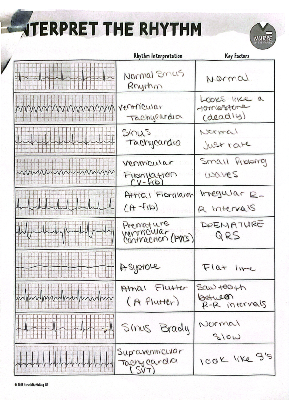 Simulation - cardiac rhythyms - TERPRET THE RHYTHM NURSE THE MAKING ...