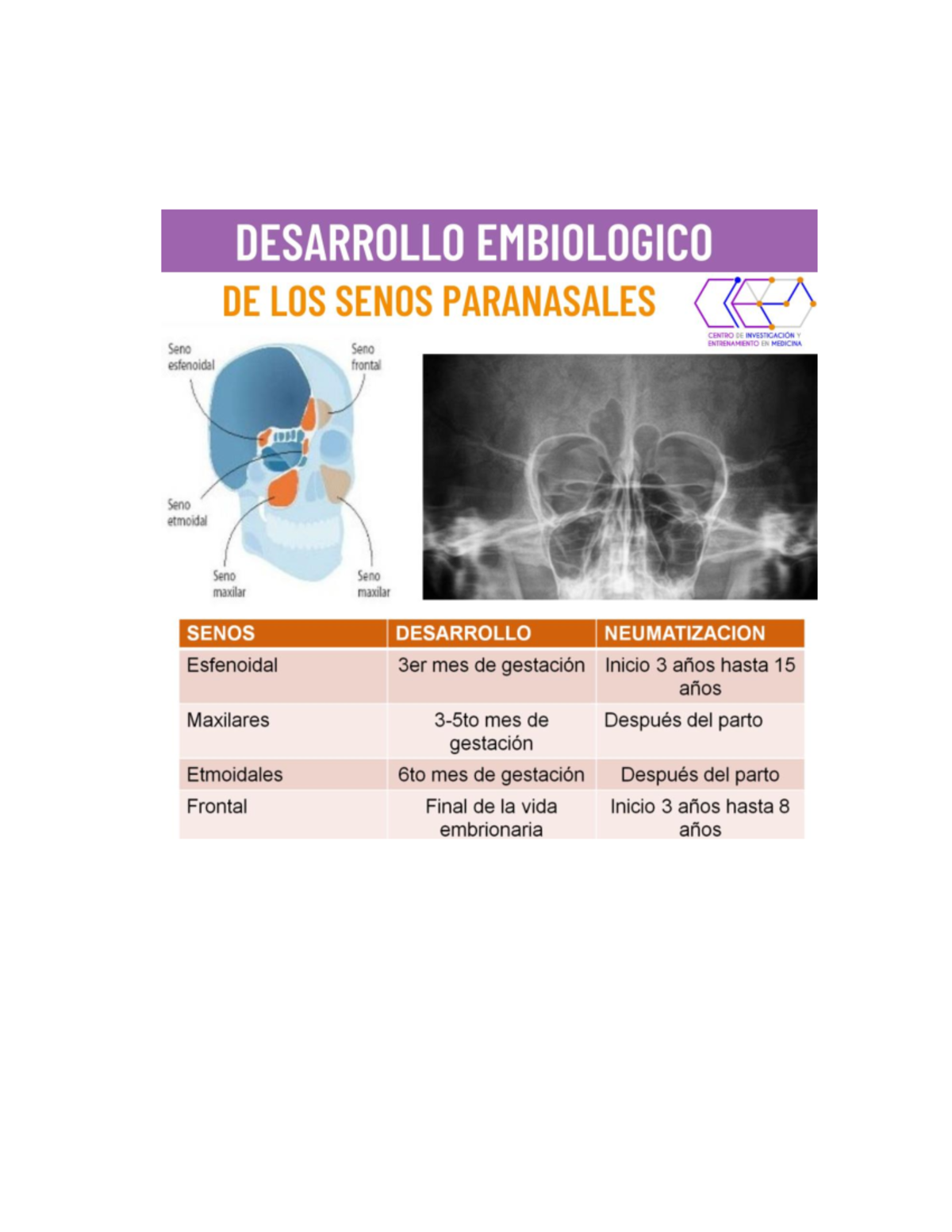 Esquema de senos paranasales - DESARROLLO EMBIOLOGICO DE LOS SENOS ...