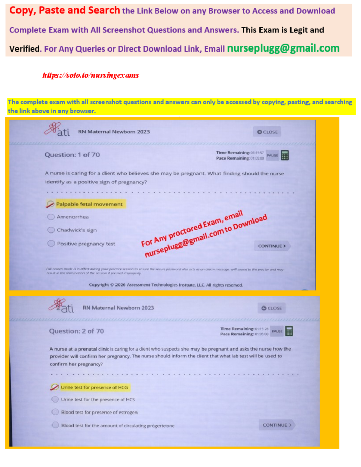 Complete ATI RN Maternal Newborn 2023-2026 Proctored Exam NGN Guide ...