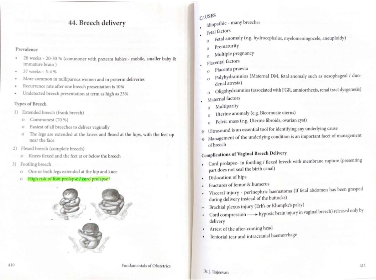 Breech Delivery Management: Causes, Types, and Techniques (OB 410 ...