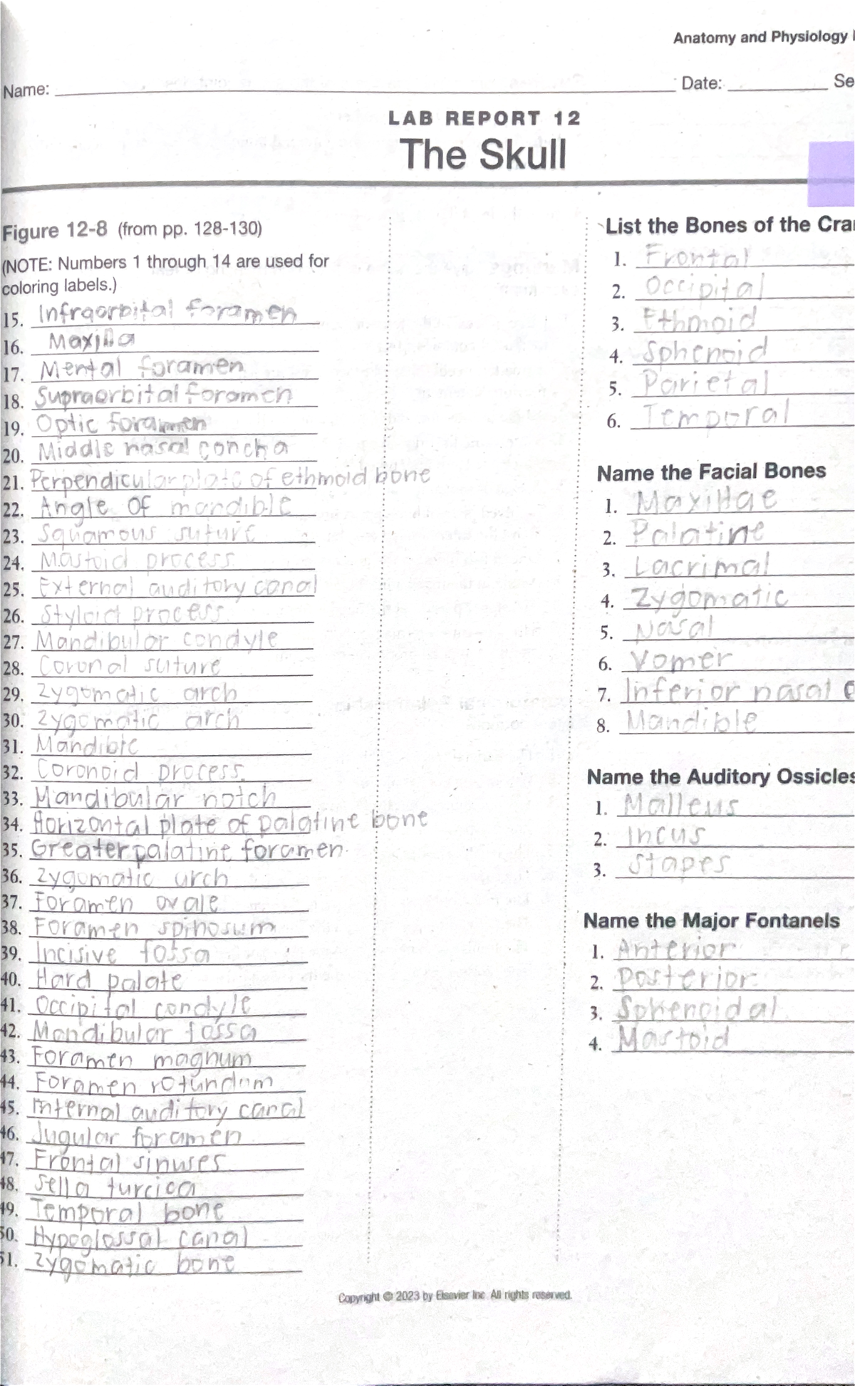 LAB Report 12 - Anatomy and Physiology - Anatomy and Physiology Jame ...