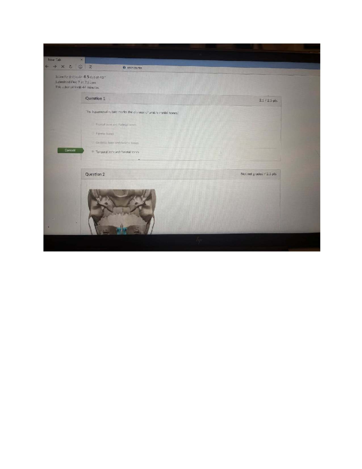 Bio151 Lab Exam 4: Skeletal Anatomy Quiz Review - Studocu