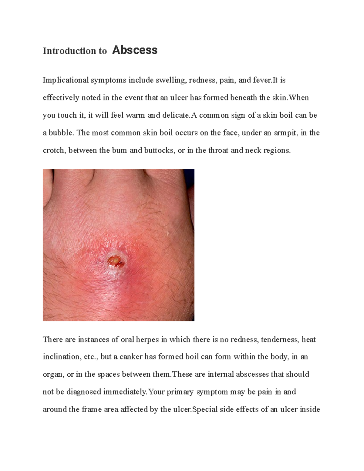 Symptoms Of An Internal Abscess