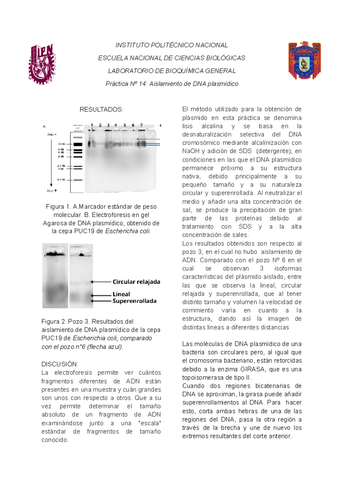 Aislamiento del DNA Plasmídico: Práctica Nº 14 de Biología - Studocu