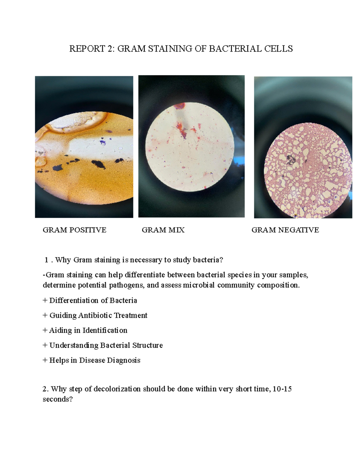 Micro 2: Importance of Gram Staining in Bacterial Identification - Studocu