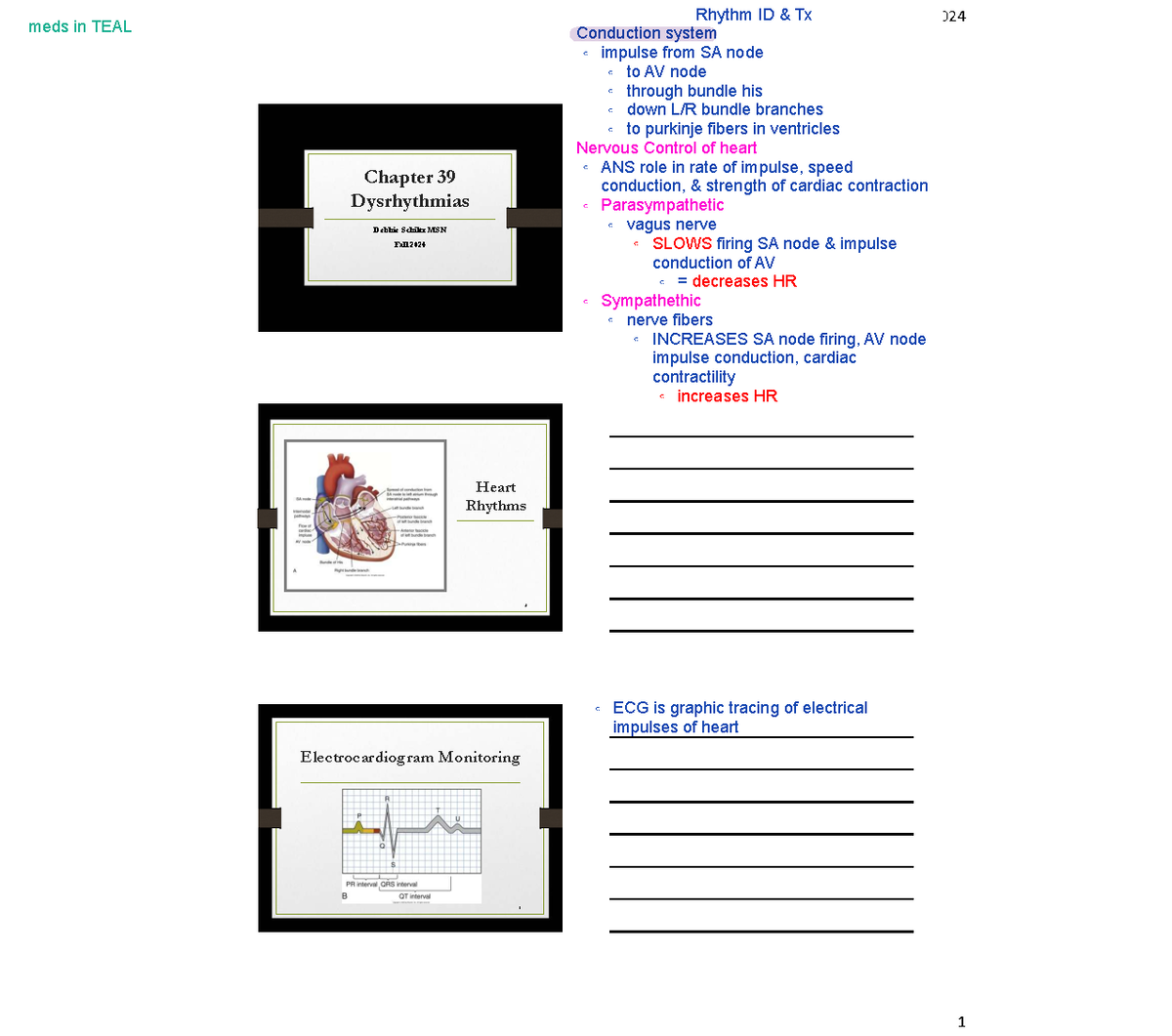 Ch 39 Dysrhythmias: Impulse Conduction & Heart Rhythm Management - Studocu