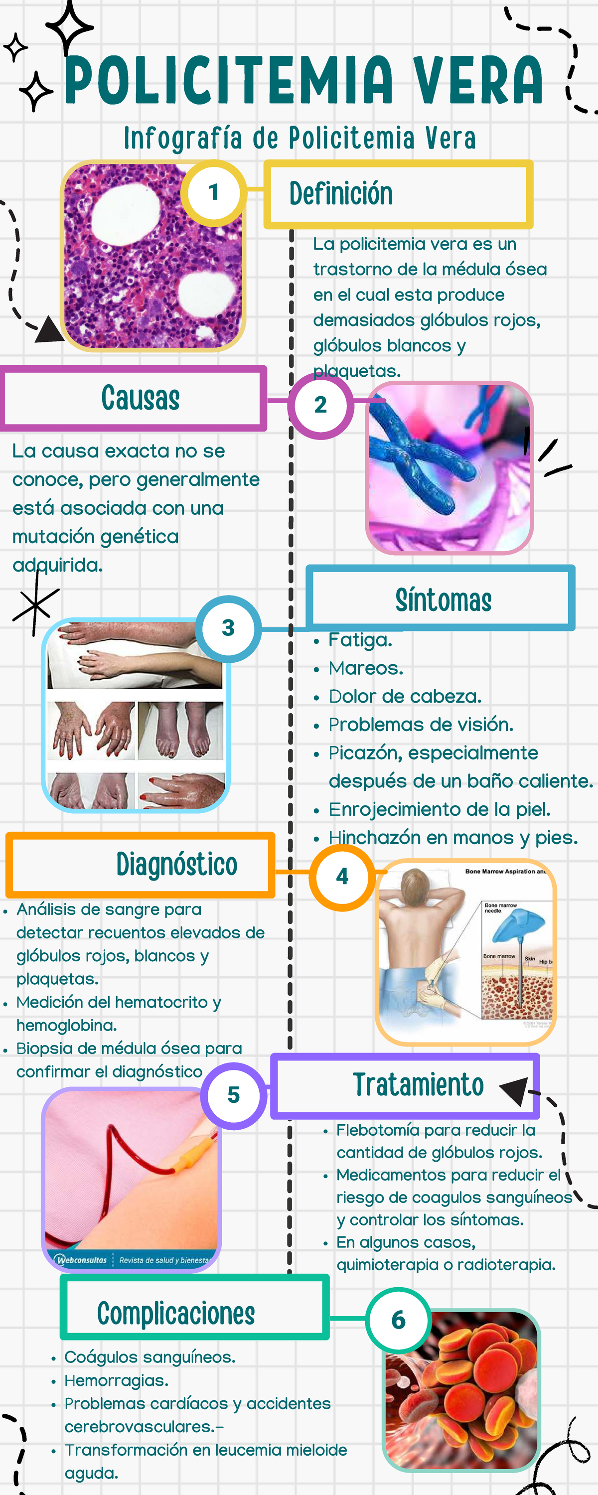 Infografía sobre Policitemia Vera y Trastornos Mieloproliferativos ...