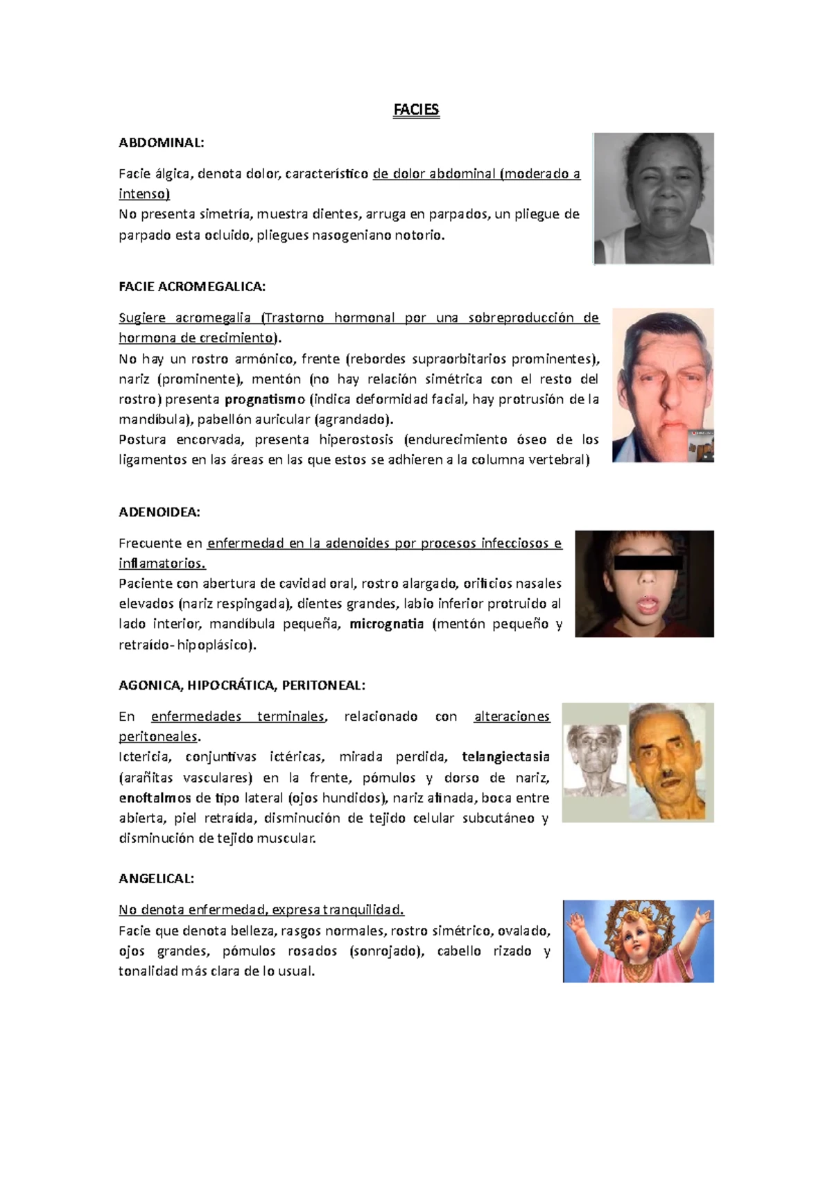 Facies clinica propedeutica - Facies Facie Febril Facie Hipocrática ...