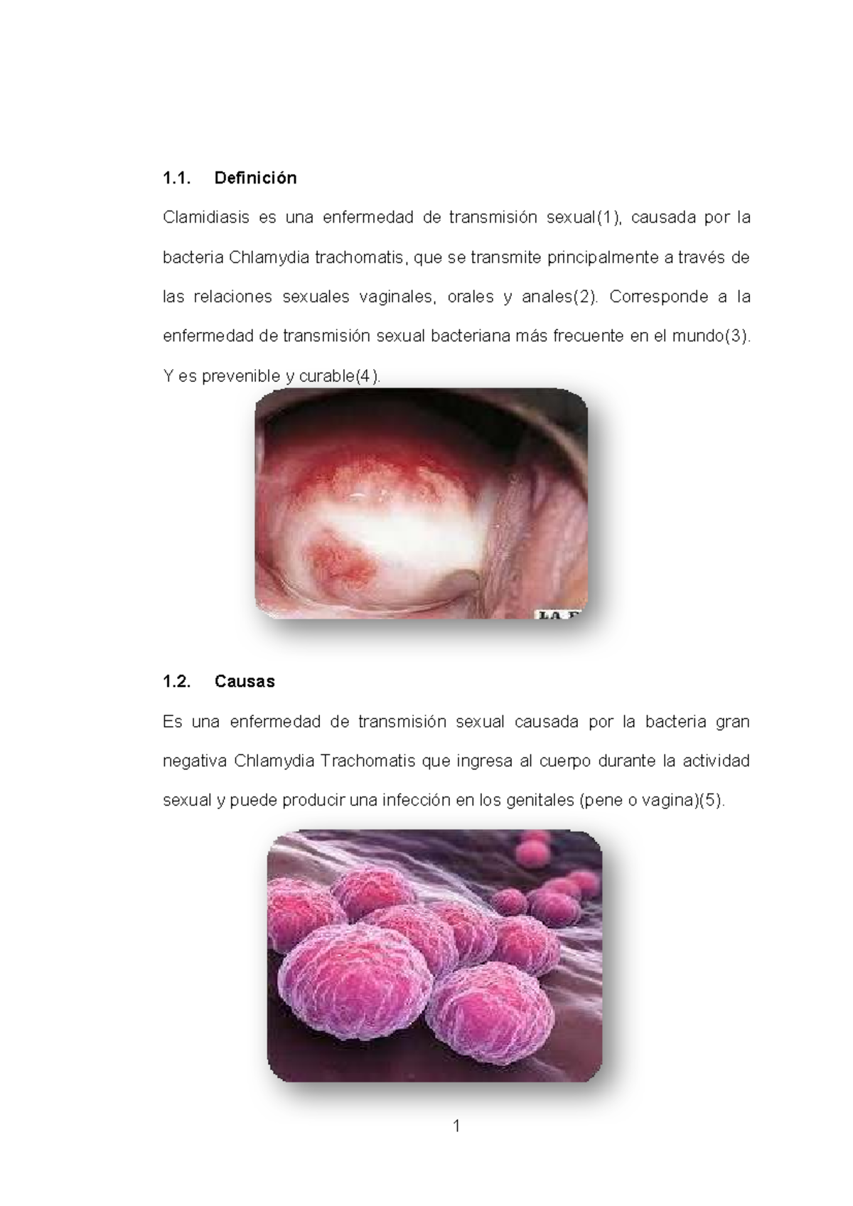 Clamidia y Otras ETS: Definición, Causas y Síntomas - LEER - Studocu