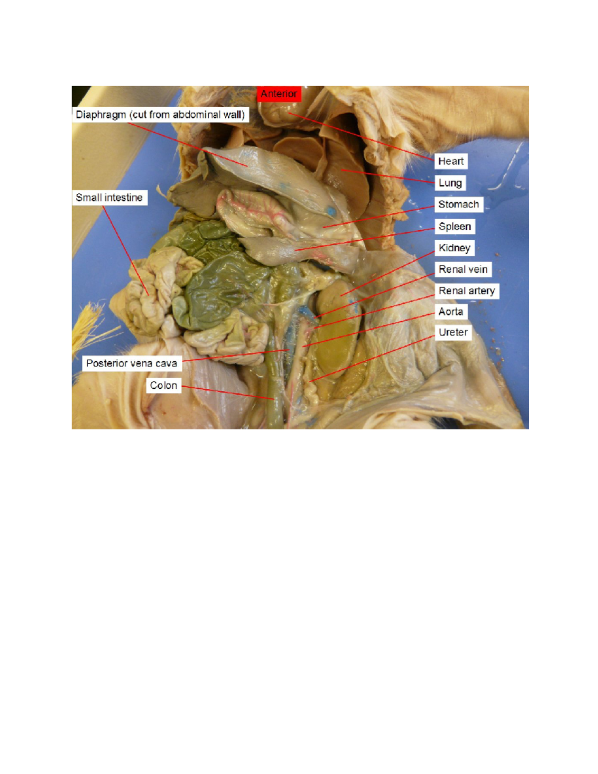 Lab Assigment - lab - Glottis: The glottis is the opening between the ...