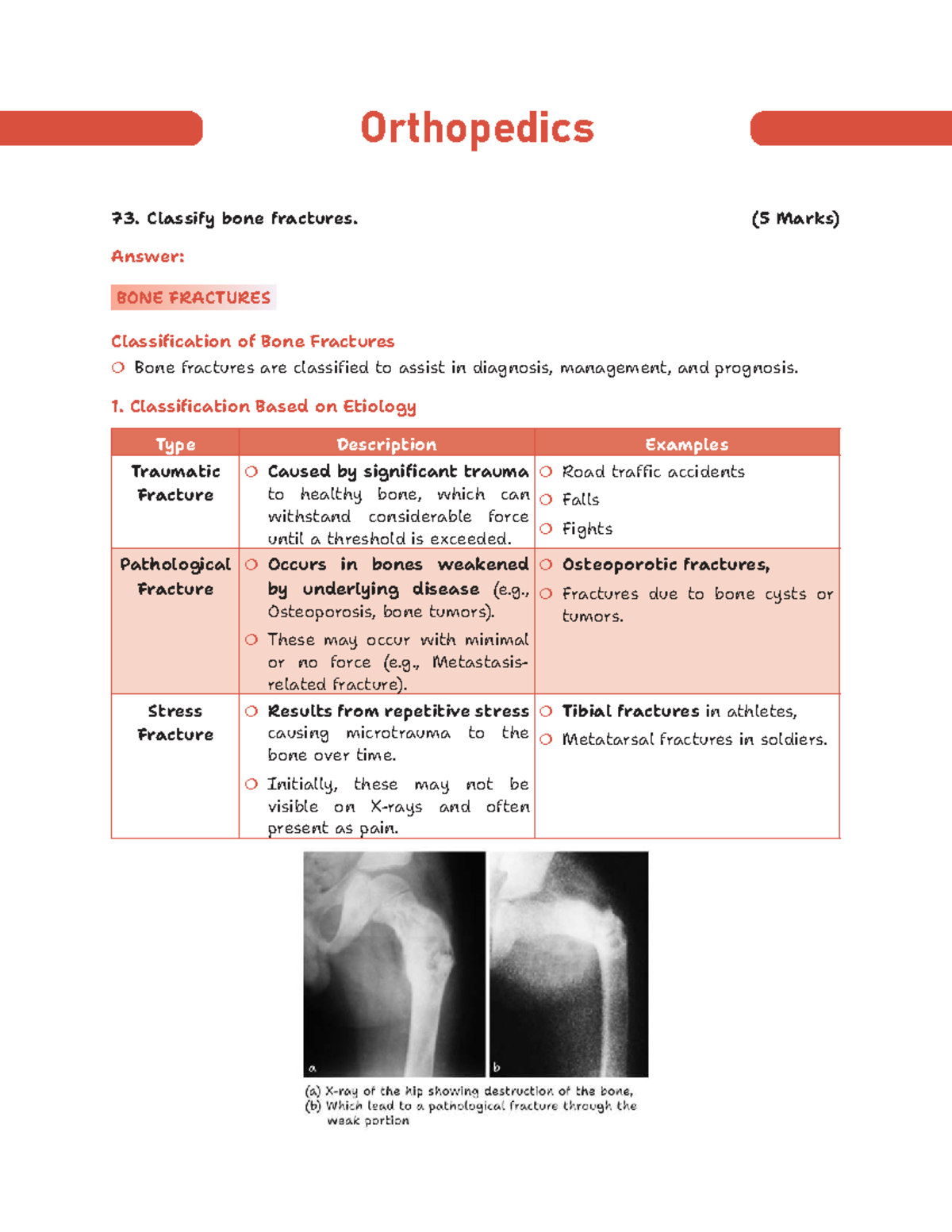 Orthopedics 73: Classification and Management of Bone Fractures - Studocu