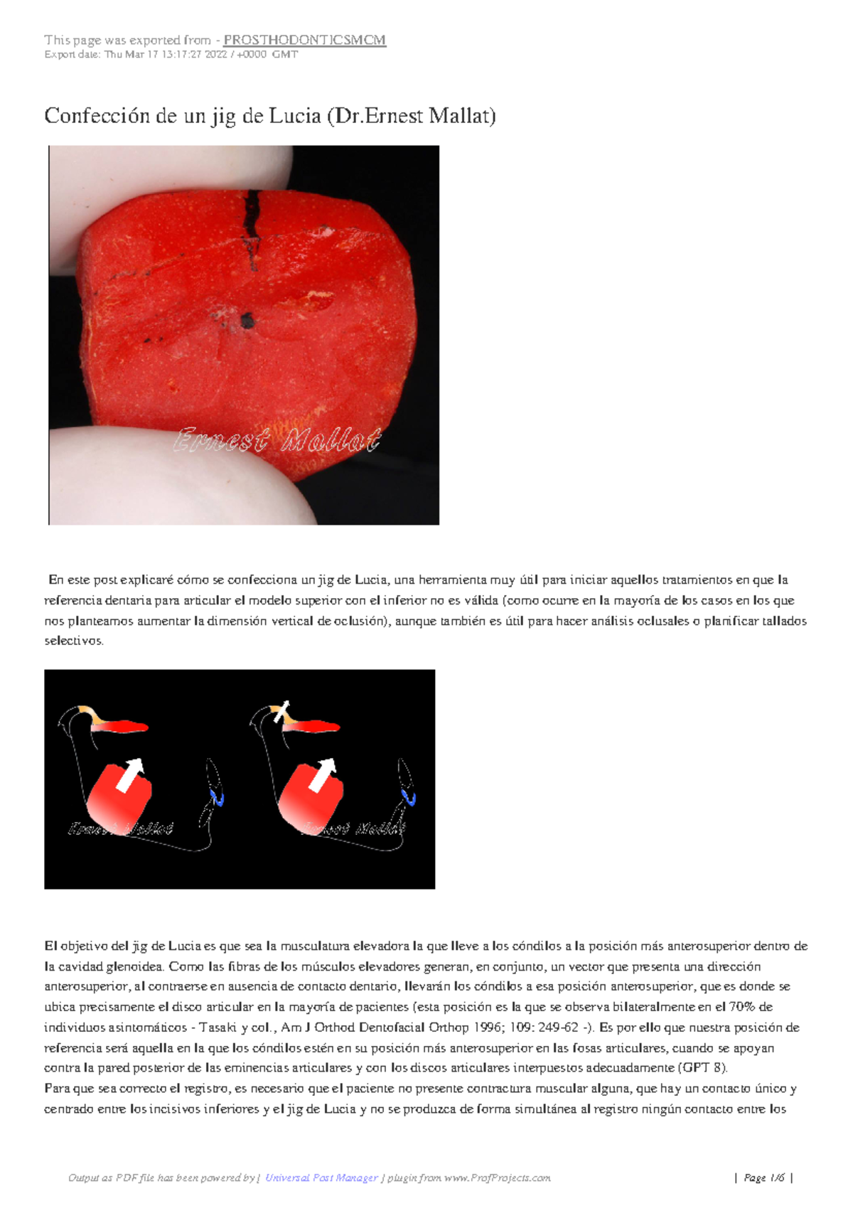 Instrucciones para la confección del Jig de Lucia en Odontología - Studocu