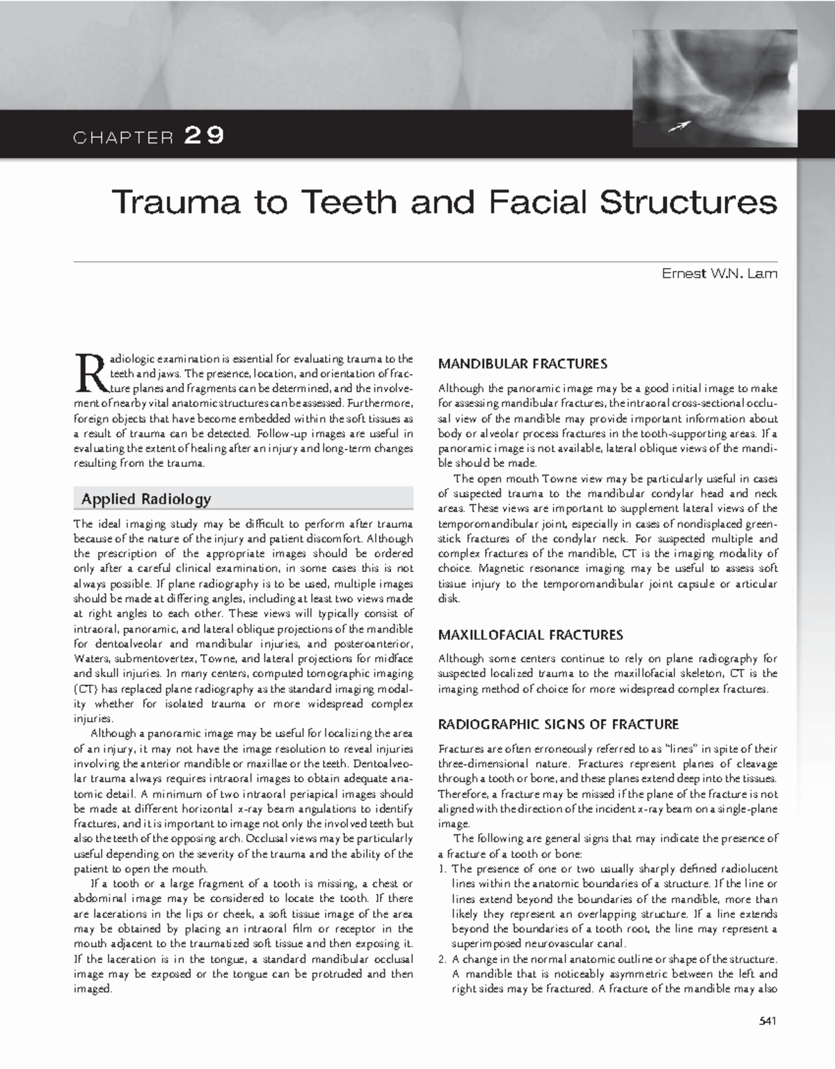 Trauma to teeth and facial structures - C H A P T E R 2 9 Trauma to ...