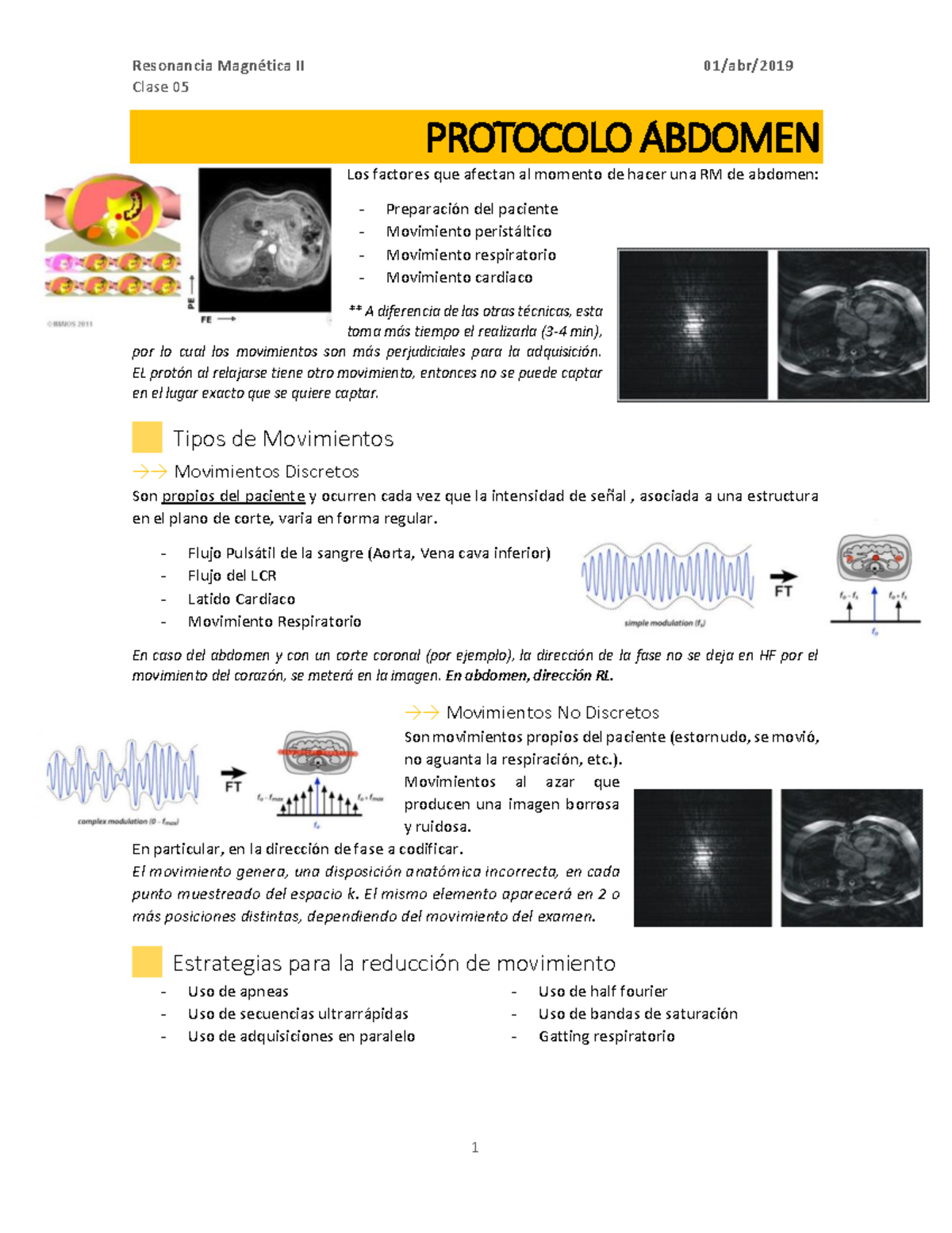 05 Protocolo Abdomen - Resonancia II Clase 05 PROTOCOLO ABDOMEN Los factores que afectan al ...