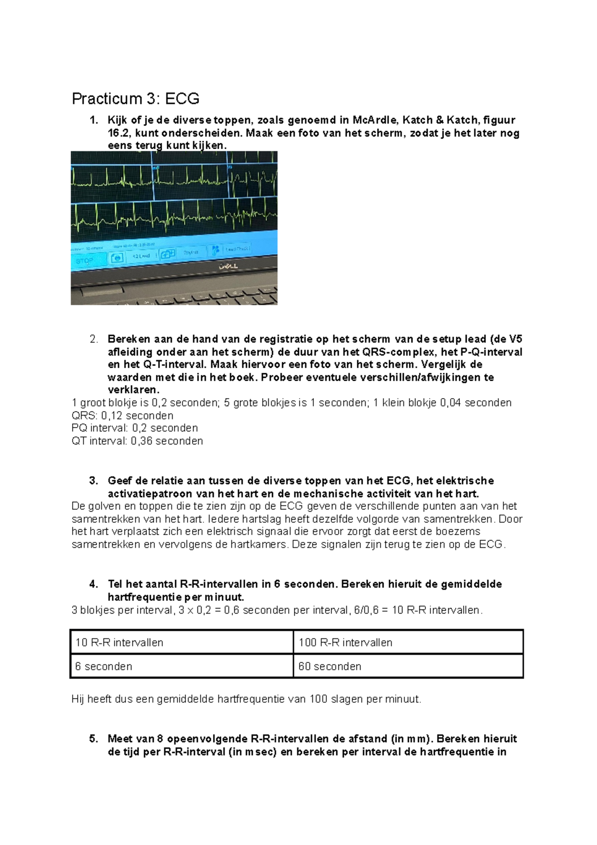 Practicum IF3: ECG Analyse en Hartfrequentie Bepaling - Studeersnel